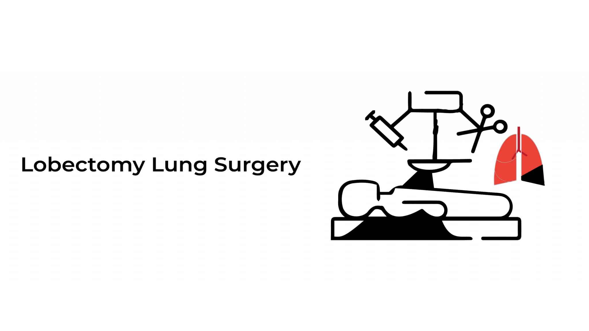 Lobectomy Lung Surgery ~ StatCardiologist