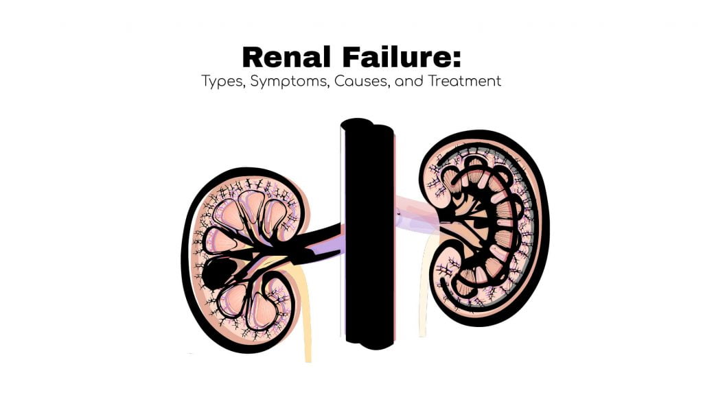 Renal Failure:Symptoms,Causes,and Treatment~ Stat! Cardiologist