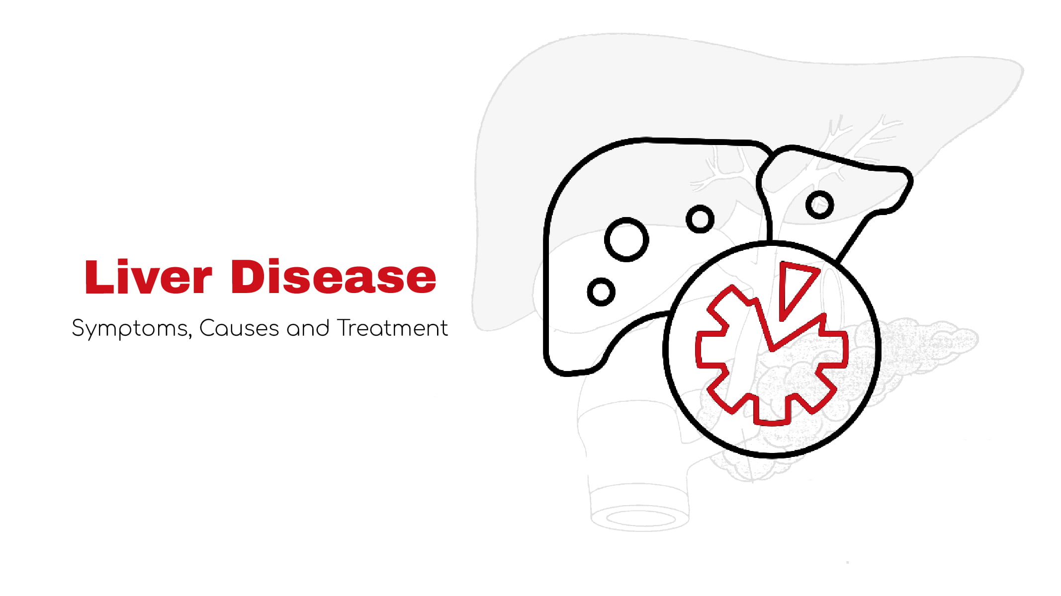 Liver Disease Symptoms Causes And Treatment ~ Statcardiologist