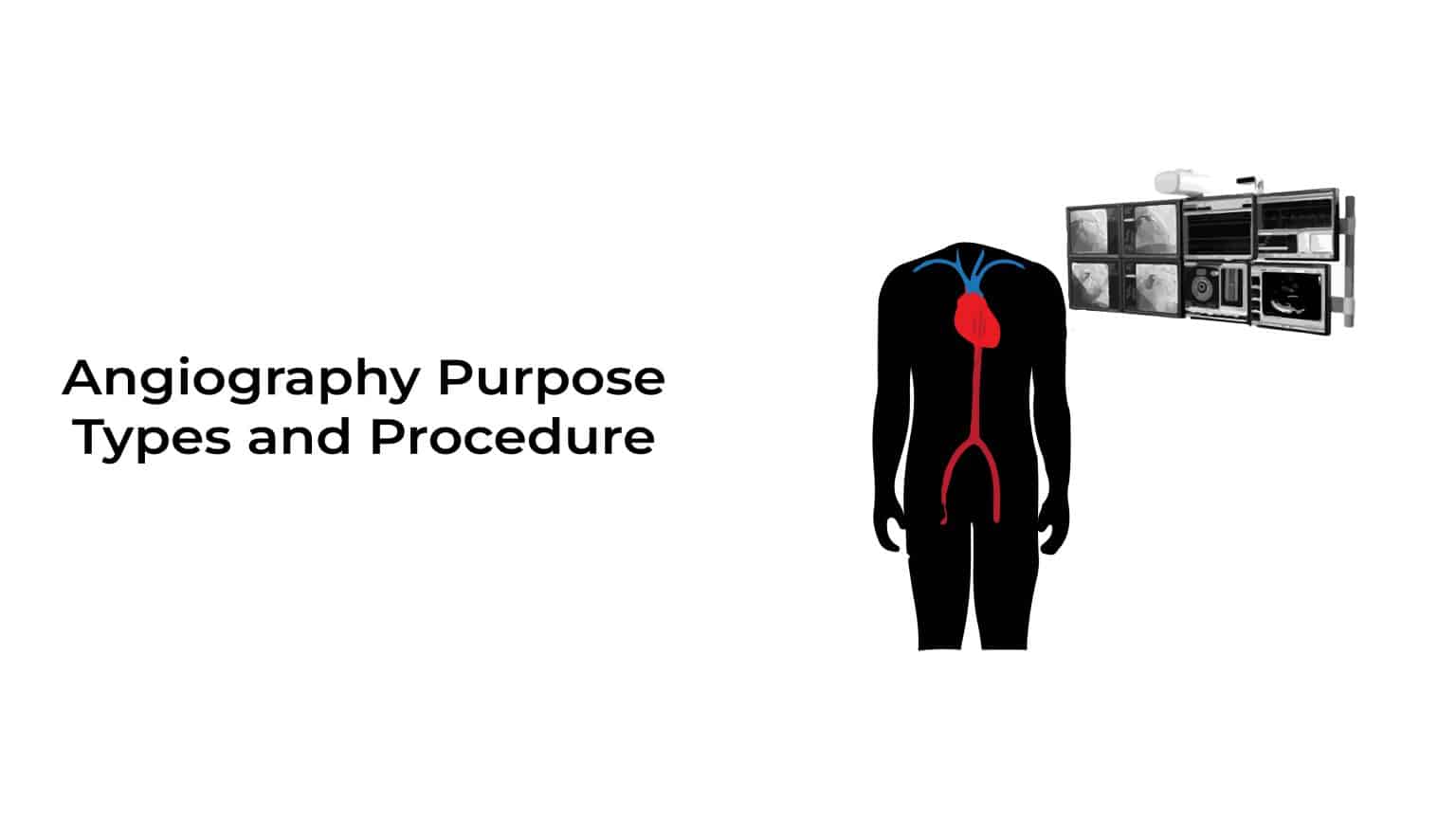 Angiography: Purpose, Types, and Procedure ~ Stat Cardiologist