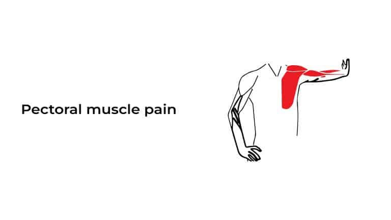 Pectoral muscle pain ~ Stat Cardiologist