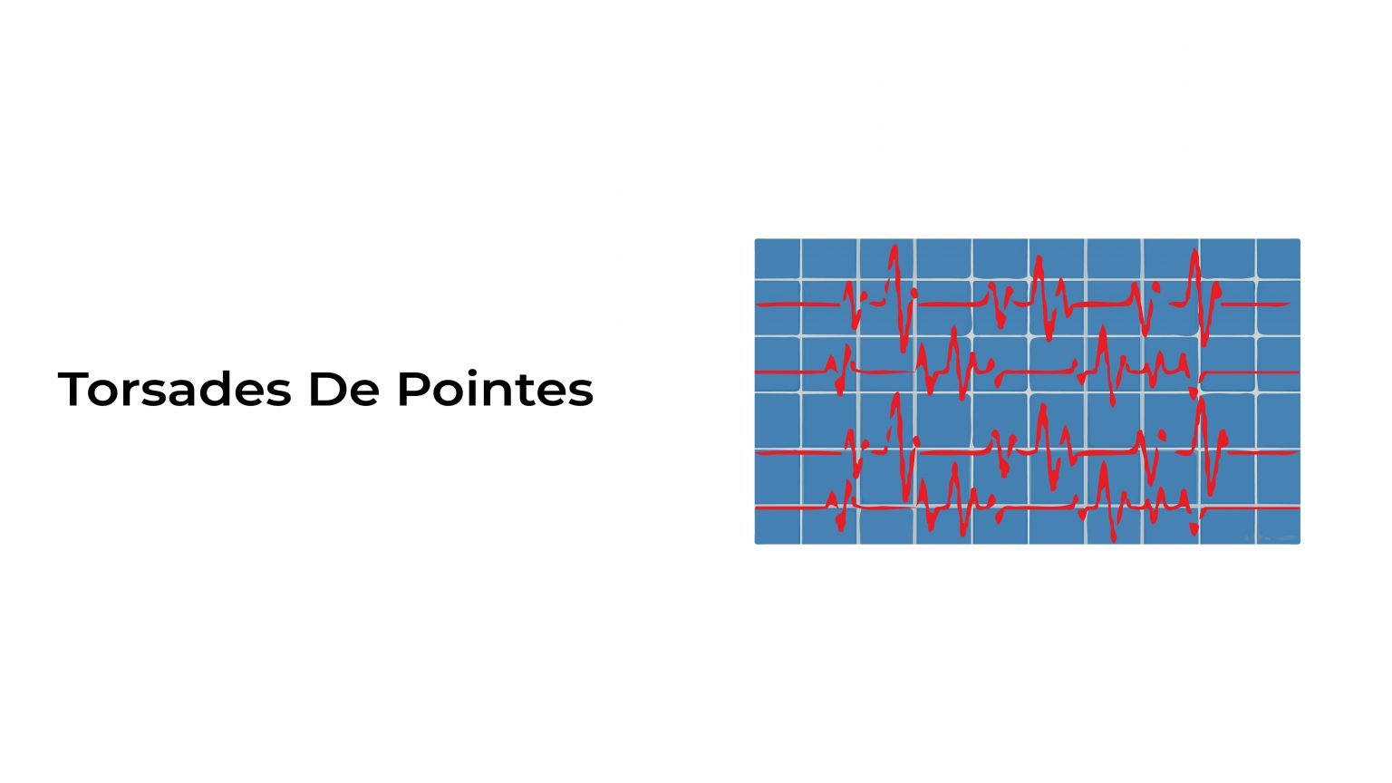 Torsades De Pointes ~ Stat Cardiologist