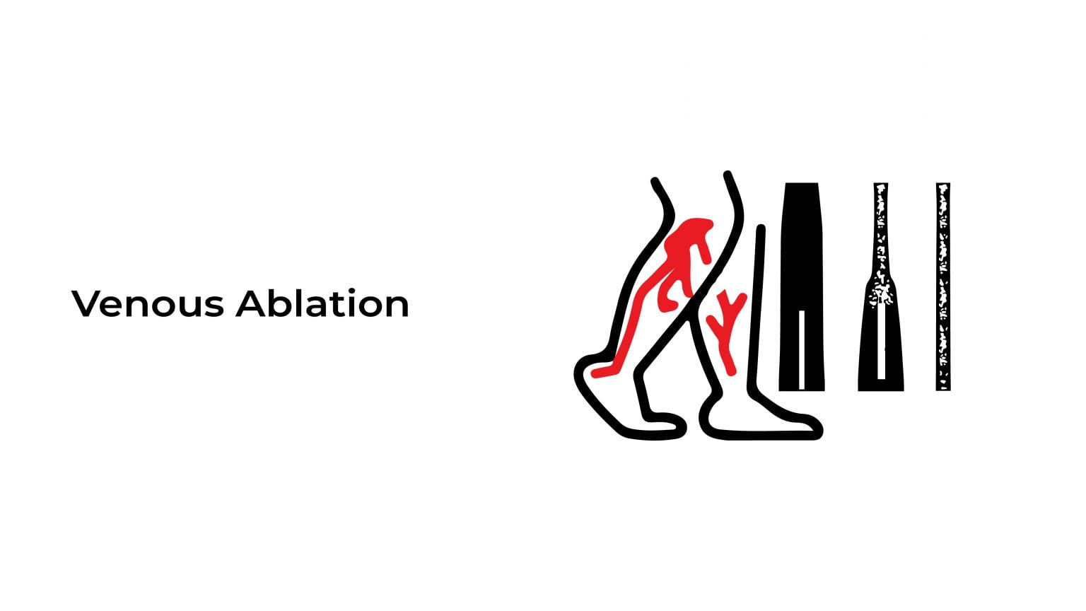 Venous Ablation ~ Stat! Cardiologist