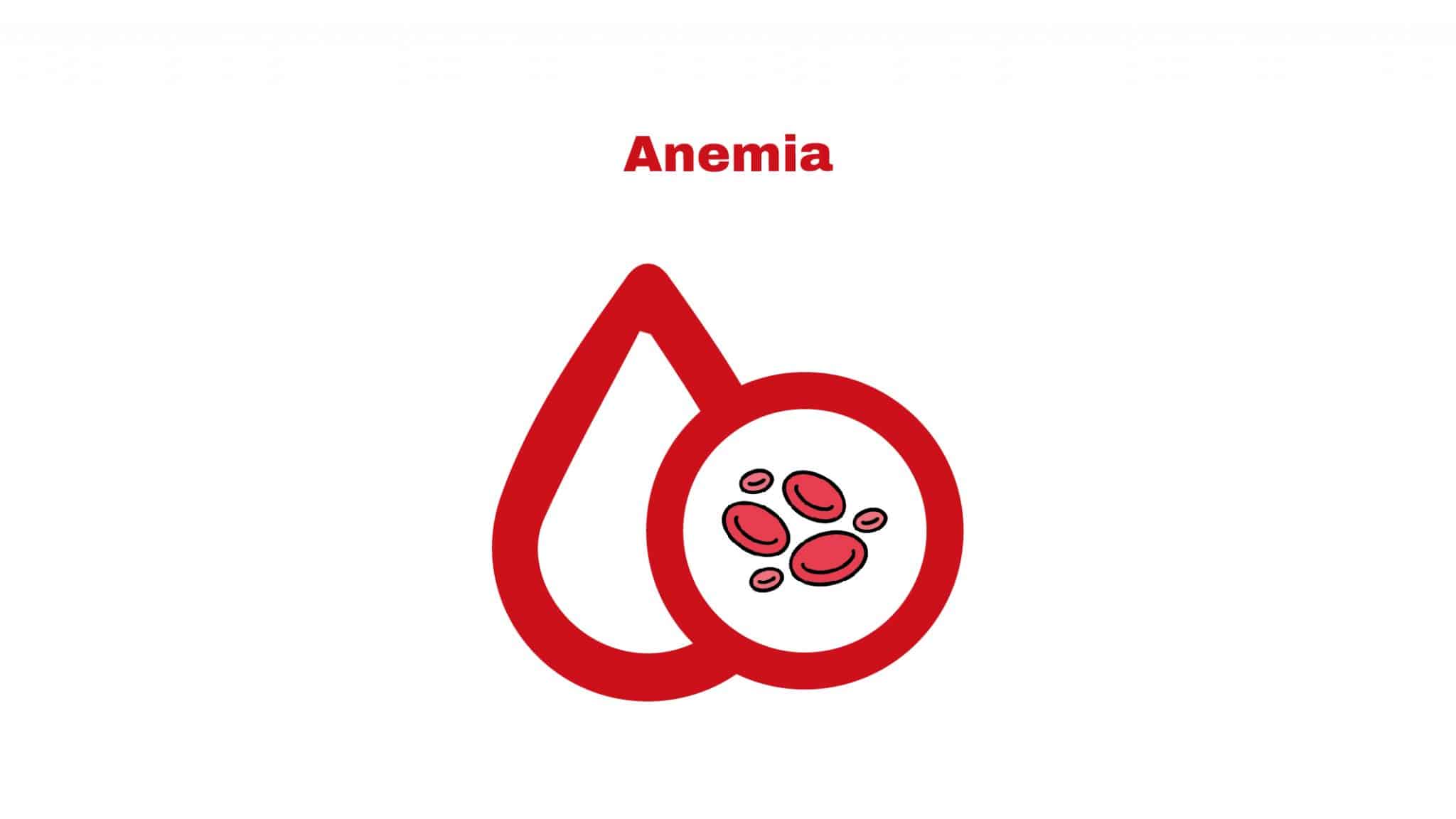 Anemia ~ Stat Cardiologist