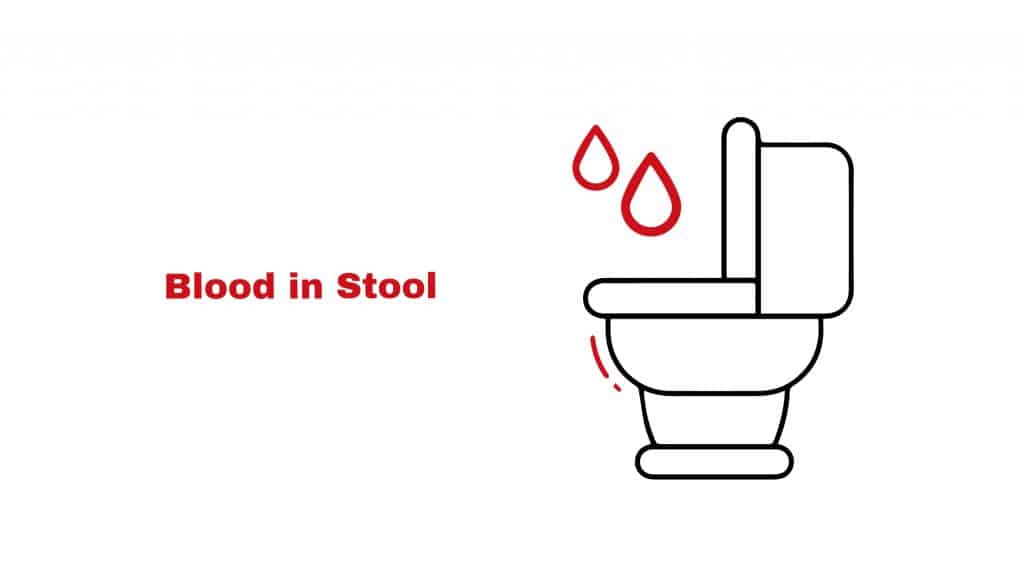 Blood in Stool ~ Stat Cardiologist