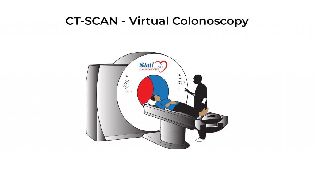 CT-SCAN – Virtual Colonoscopy – Virtual Colonoscopy