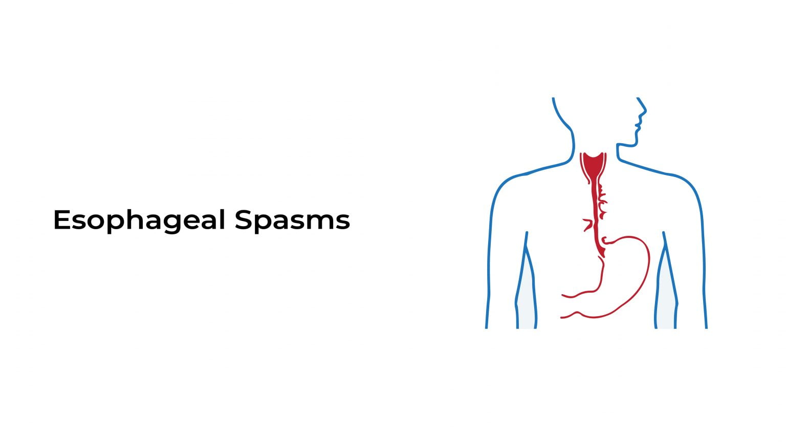 Esophageal Spasms ~ Stat Cardiologist