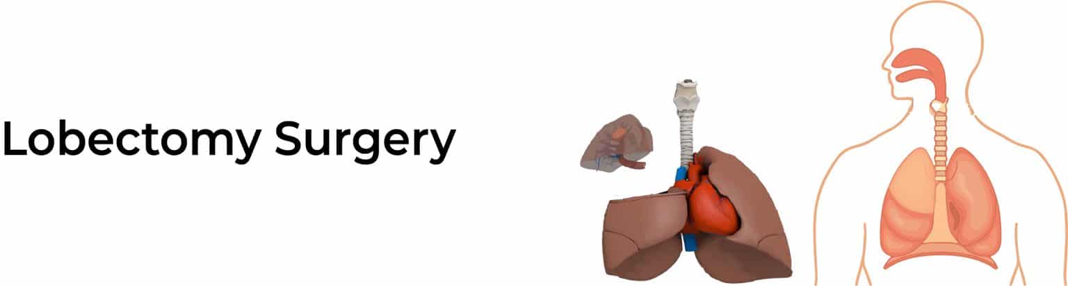 Lobectomy Surgery ~ Stat Cardiologist