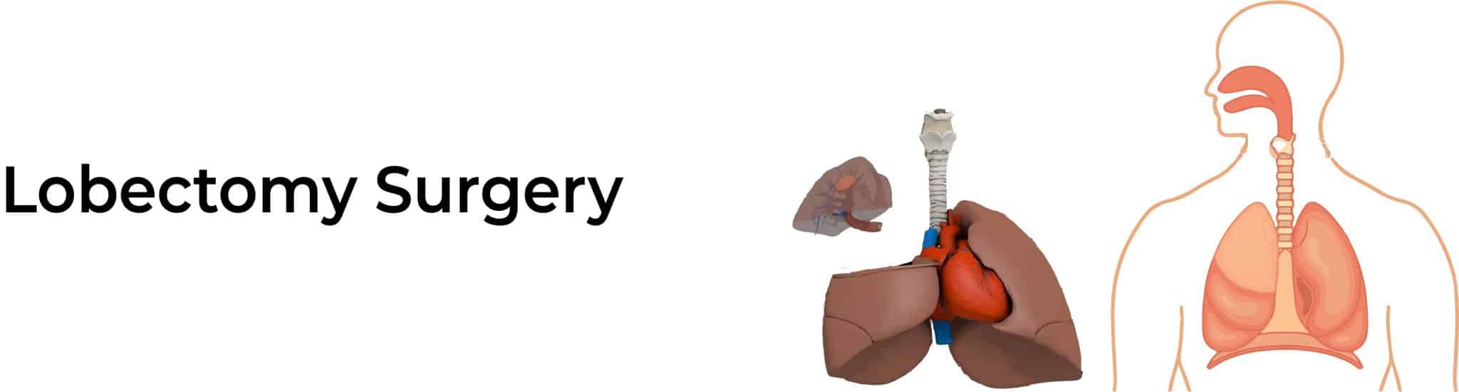 Lobectomy Surgery ~ Stat Cardiologist