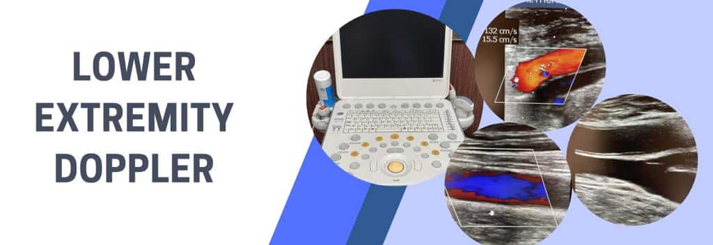 Lower extremity doppler ~ Stat Cardiologist