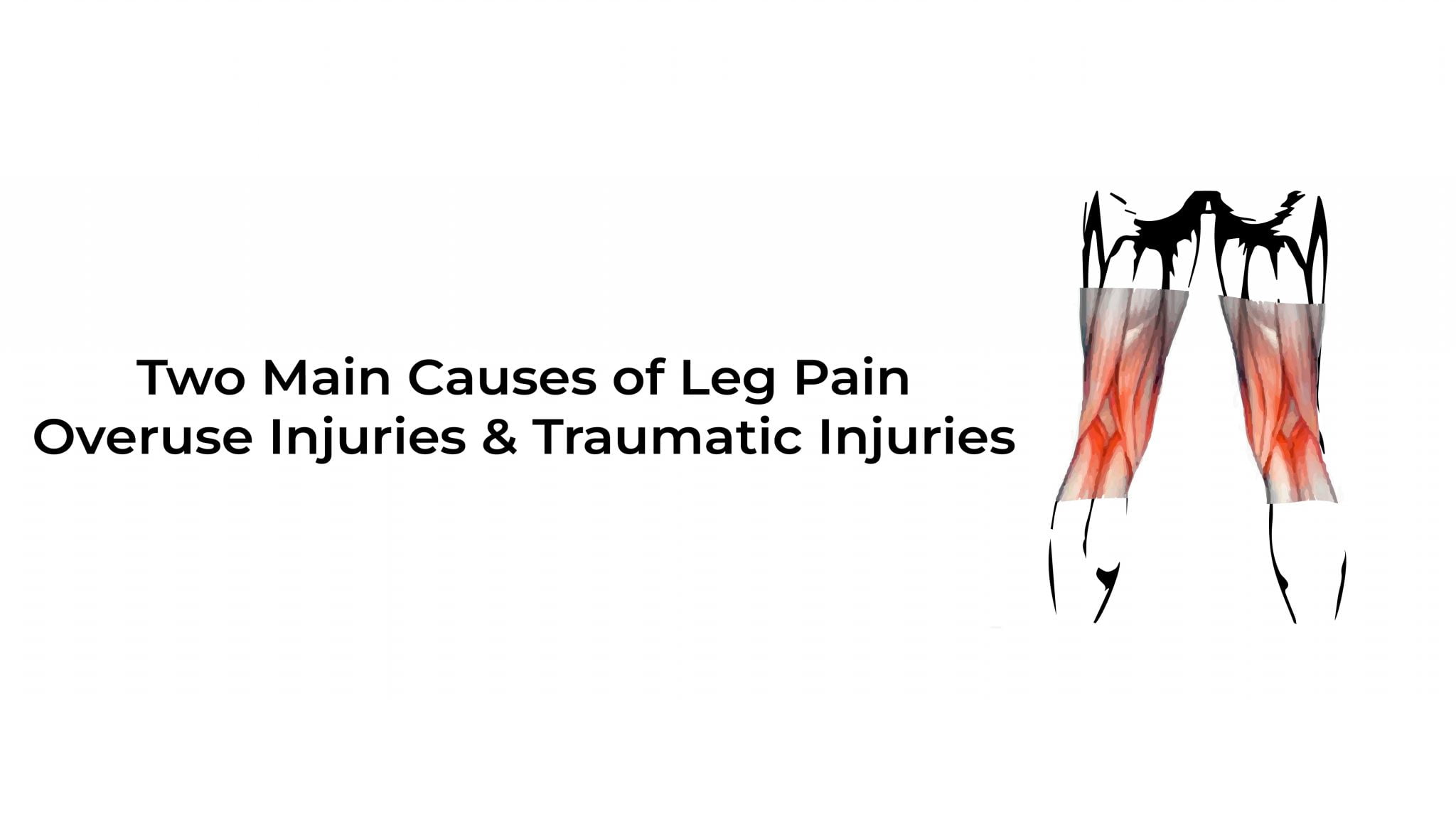 Two main Causes of Leg Pain | Do you Know? ~ Statcardiologist